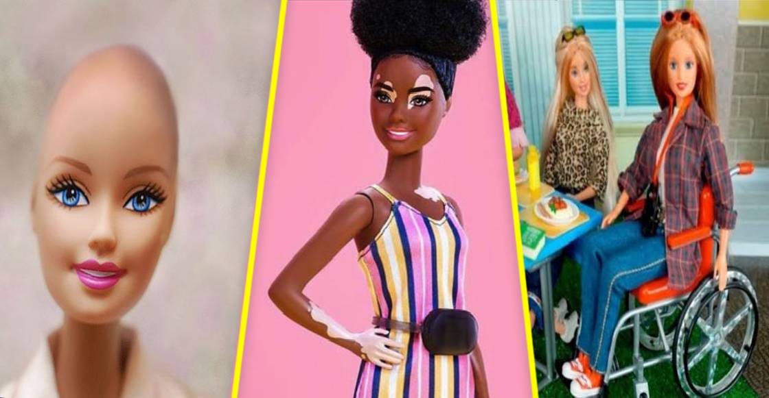 Con prótesis, vitiligo, o sin cabello: Así es la línea inclusiva de ...