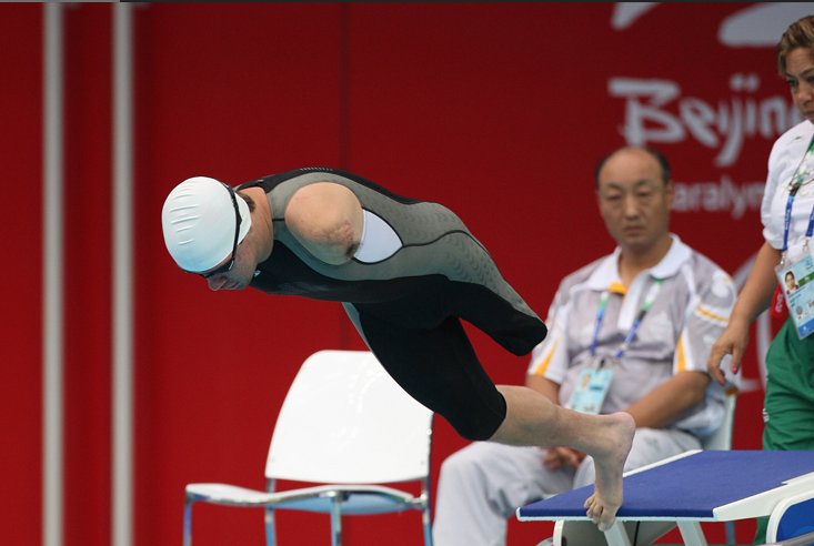 Juan Ignacio Reyes, de perder ambos brazos y una pierna a ser ...