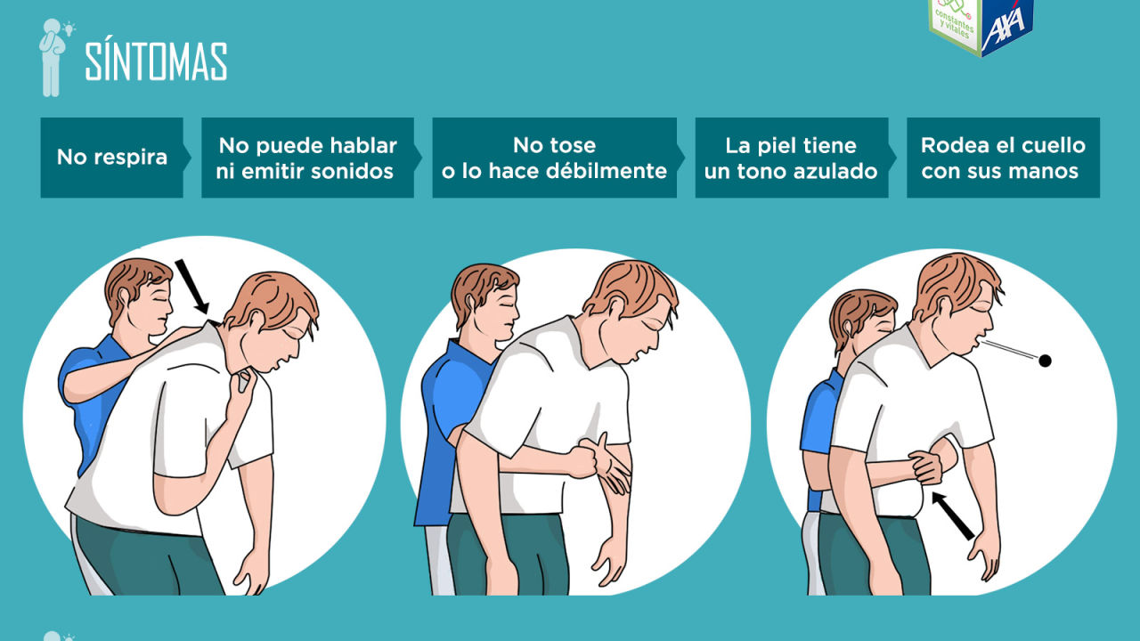 Información que salva: ¿Qué es la maniobra de Heimlich y cómo se aplica?