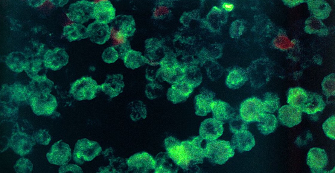 ¿Qué es la ameba 'comecerebros' que se cobró la vida de un niño en EU?