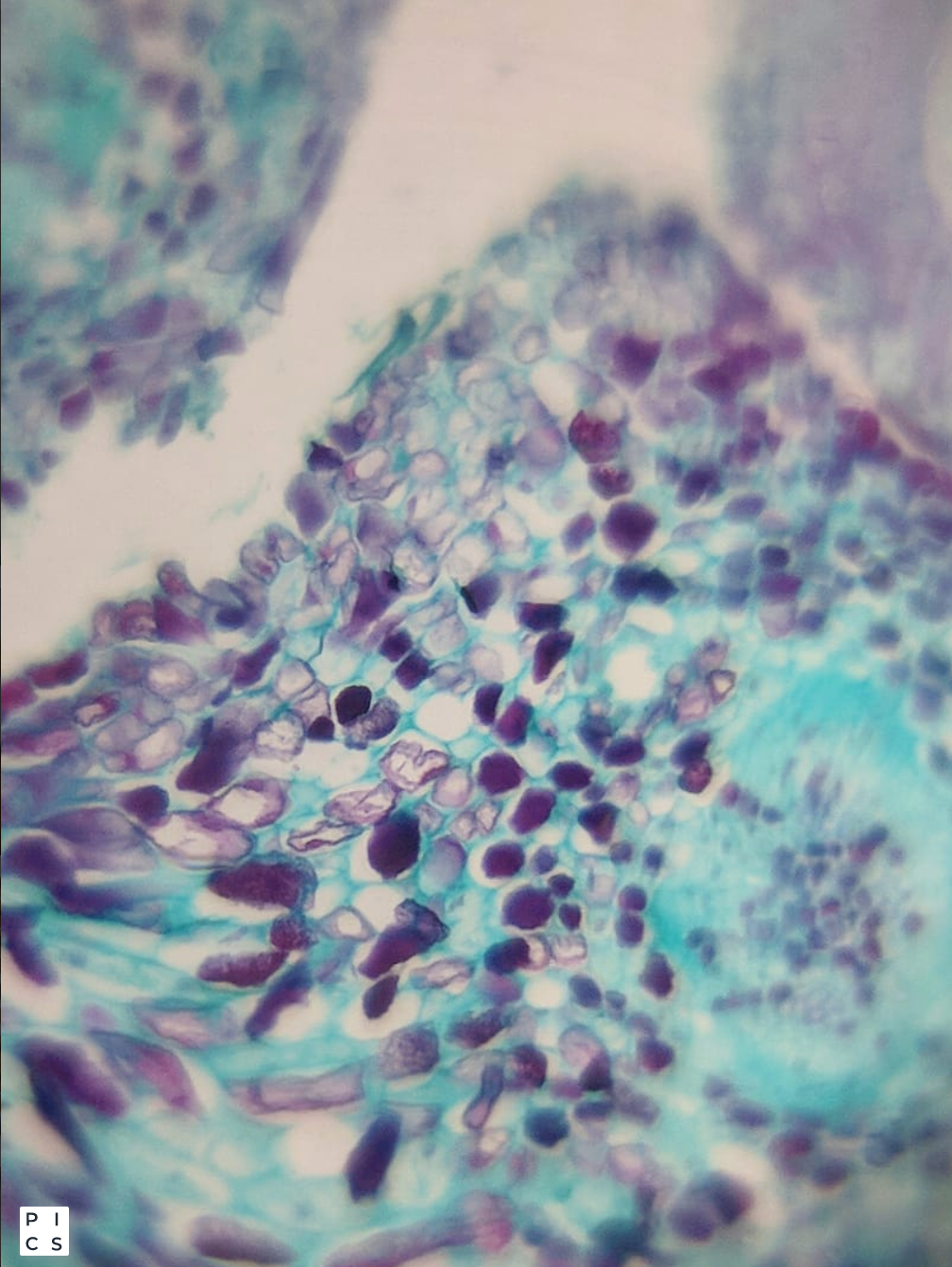 Foldscope: El microscopio de papel que cuesta poco más de un dólar