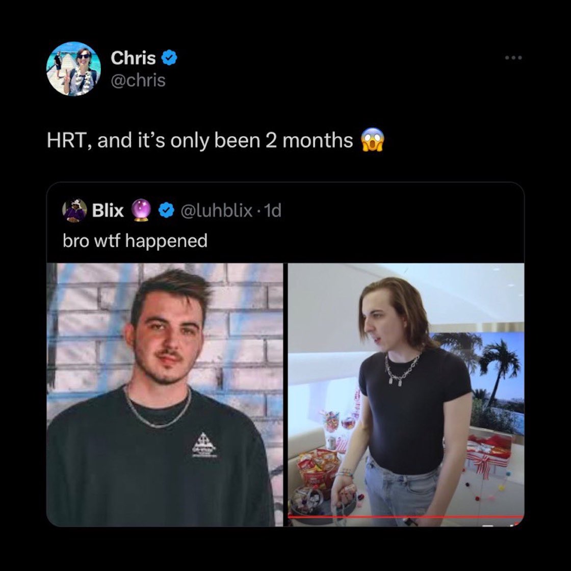 Mr. Beast y la inesperada defensa contra la transfobia
