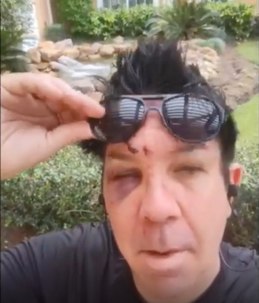 ¿Recuerdan a Crazy Town? Así la pelea a golpes entre 2 miembros