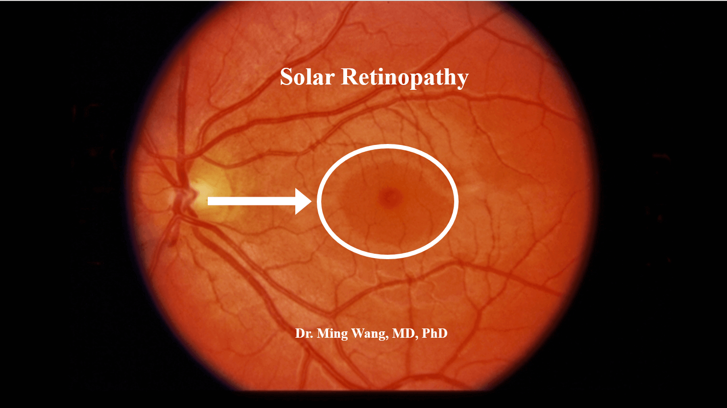 Embarazadas y terremotos: Mitos sobre el eclipse solar que no son reales