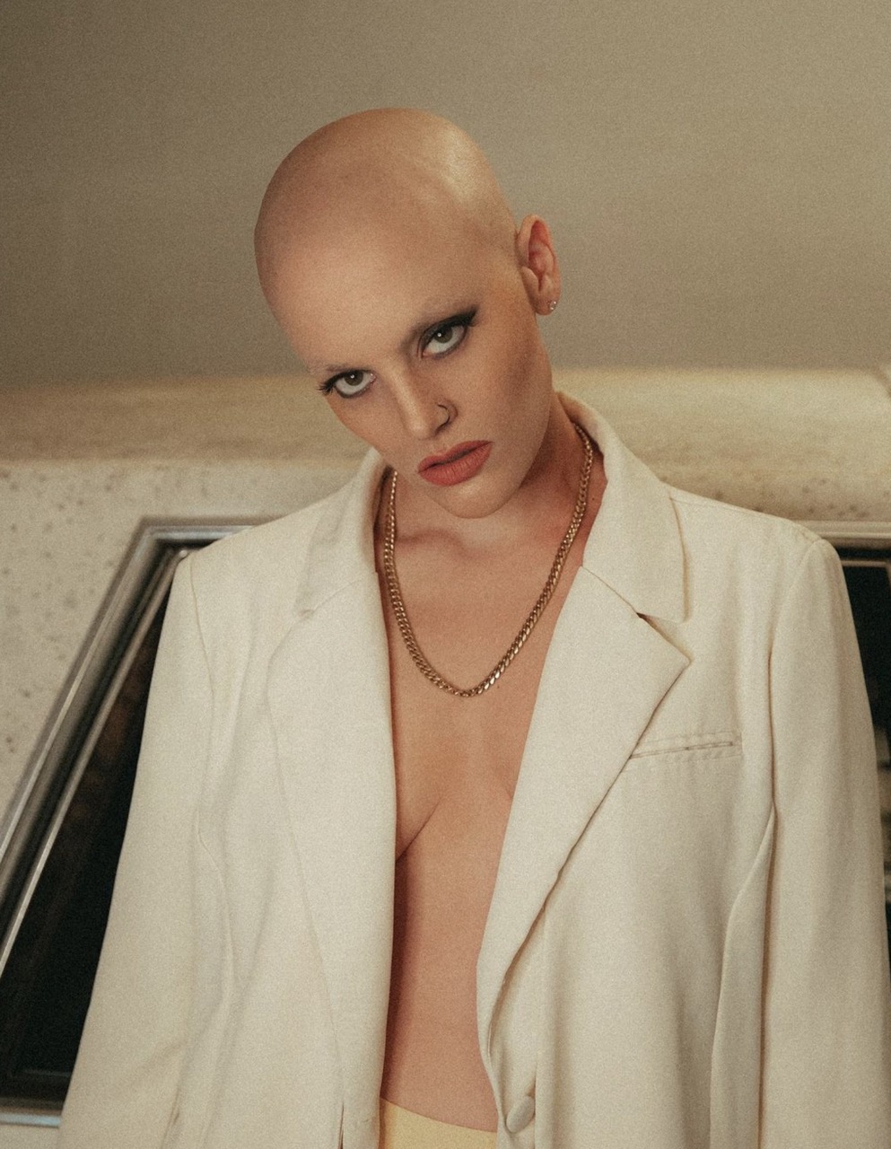 Cat Janice: La historia de la cantante con cáncer y por qué viralizó su ...