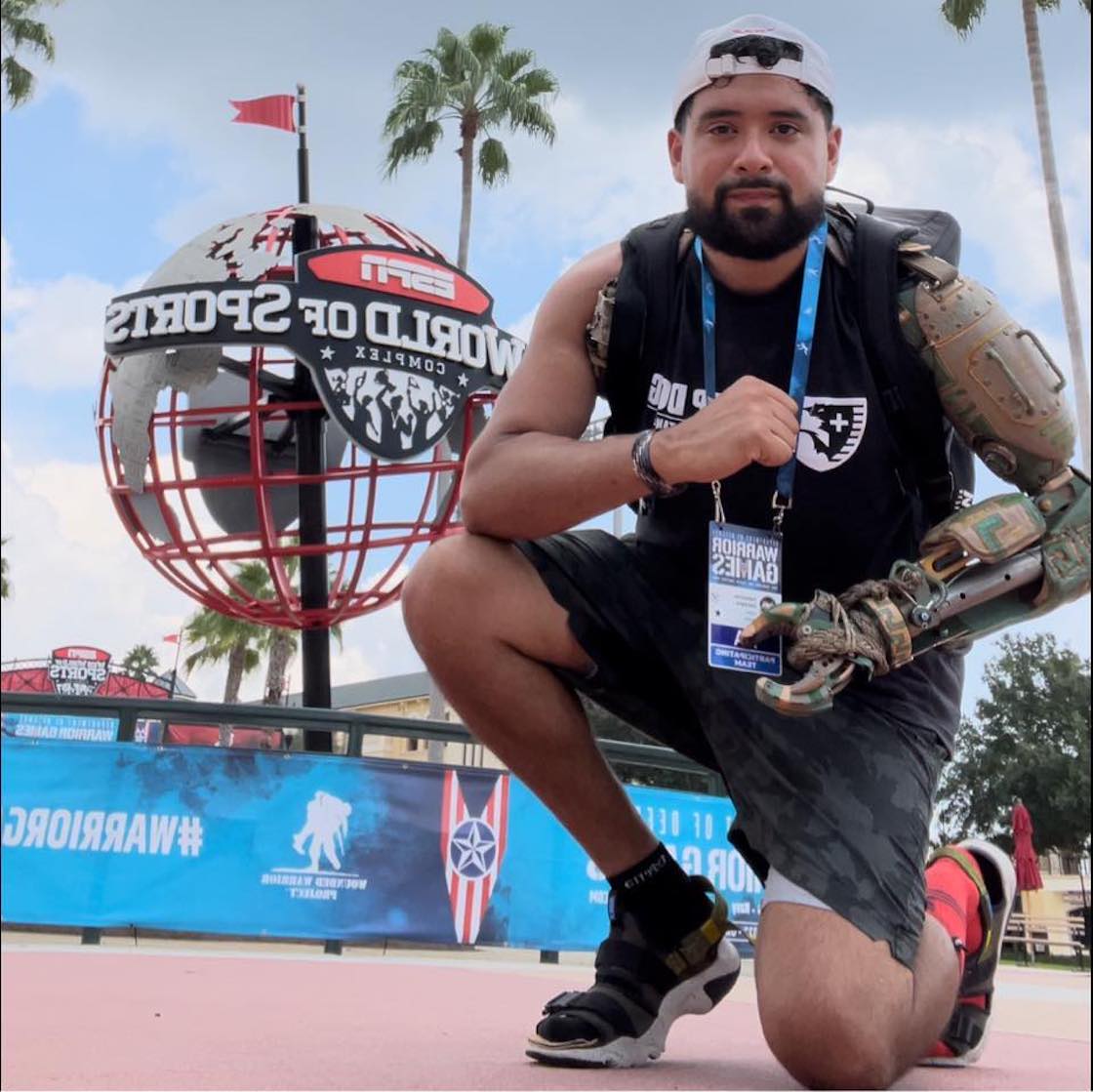 La historia de Sebastián Gallegos y su increíble prótesis