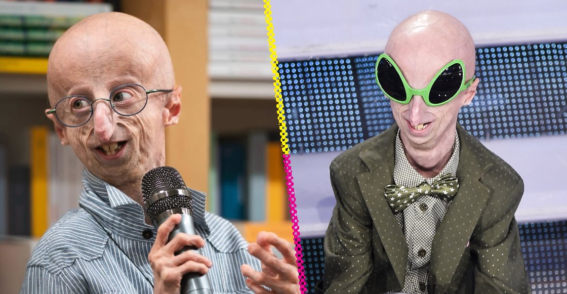 Muere a los 28 años Sammy Basso, científico que buscaba cura para su ...