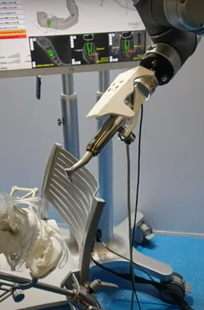 Yakebot, el primer robot dentista que hace cirugías con "precisión ...