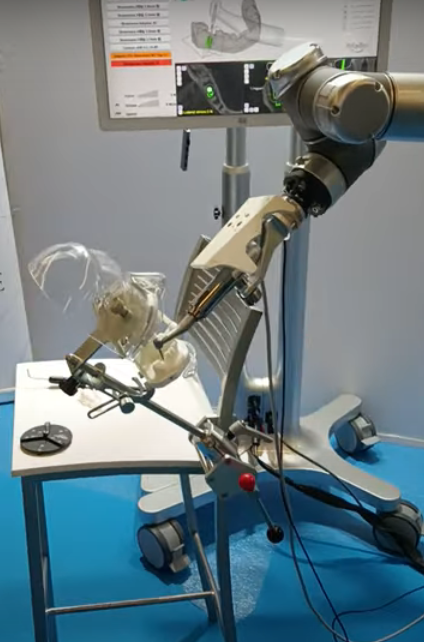 Yakebot, el primer robot dentista que hace cirugías con "precisión ...