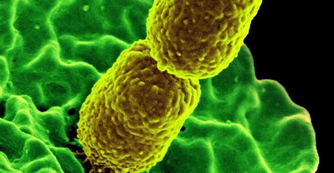 Bacteria Klebsiella Oxytoca en México: ¿Qué es, cuáles son los síntomas ...